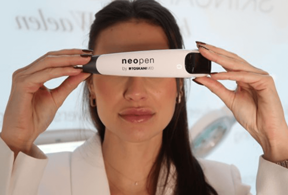 Microneedling behandeling in Amsterdam | Dermapen / Neopen